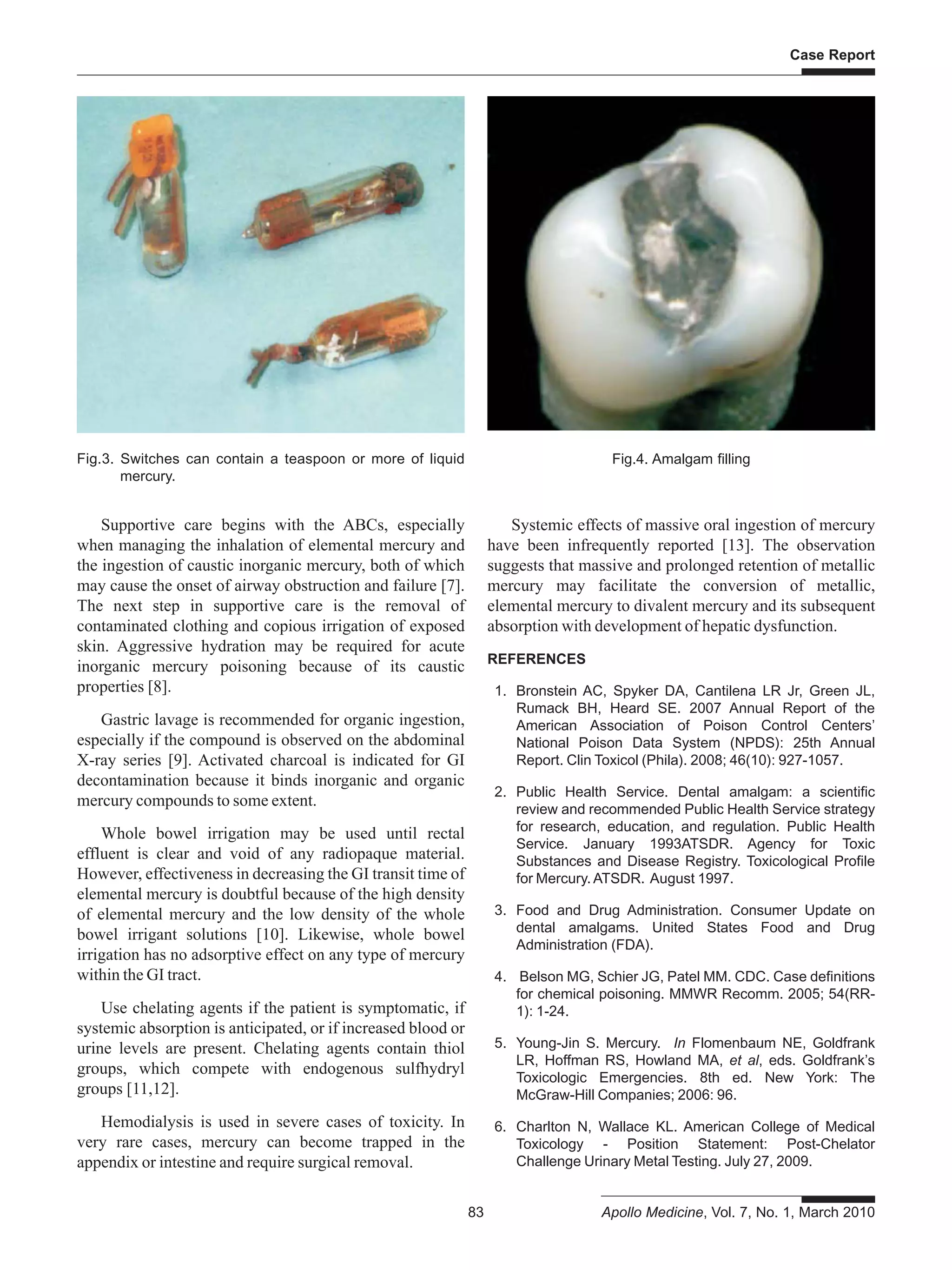 Radiopaque Shadows in the Abdomen | PDF