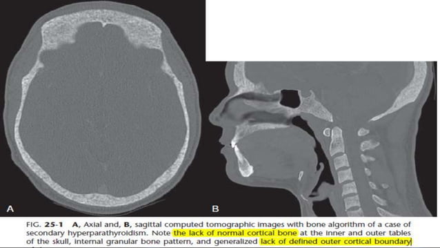 Systemic Diseases Manifested in the Jaws | PPTX