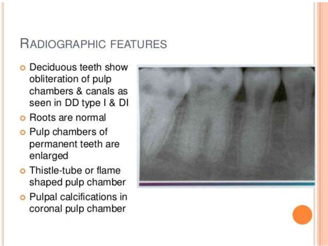 Radio pulp diseases | PPTX | Dental Health | Diseases and Conditions