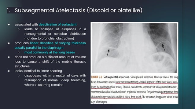 Recognizing Atelectasis, Pleural Effusion and Pneumonia | PDF | Lung and Respiratory Health ...