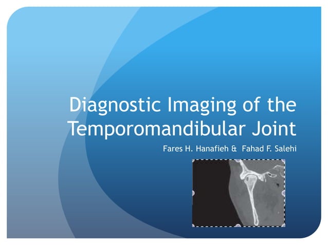 Radiographic imaging of TMJ | PPTX | Bone and Joint Conditions ...