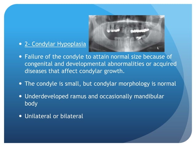 Radiographic imaging of TMJ | PPTX | Bone and Joint Conditions ...
