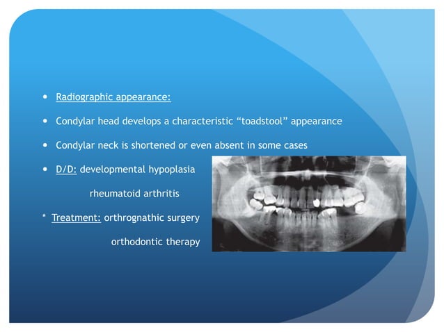 Radiographic imaging of TMJ | PPTX | Bone and Joint Conditions ...
