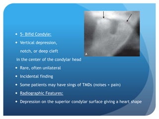 Radiographic imaging of TMJ | PPTX
