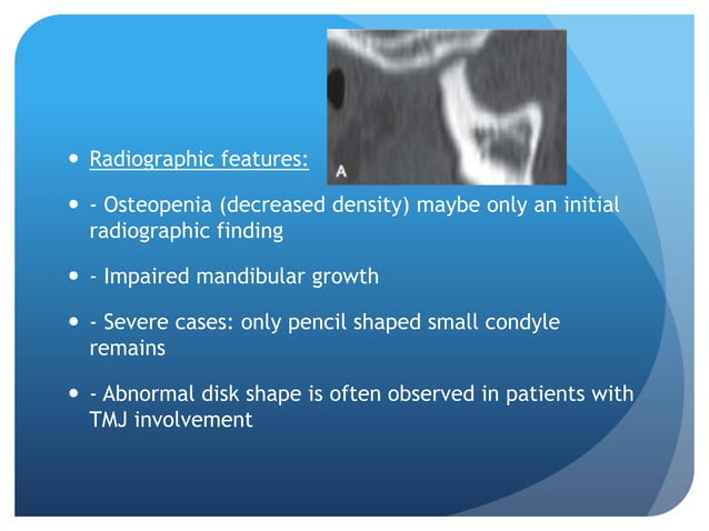 Radiographic imaging of TMJ | PPTX | Bone and Joint Conditions ...