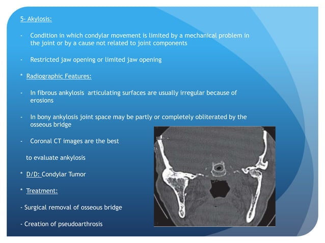 Radiographic imaging of TMJ | PPTX | Bone and Joint Conditions ...