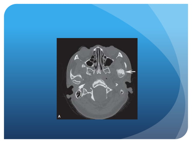 Radiographic imaging of TMJ | PPTX | Bone and Joint Conditions ...