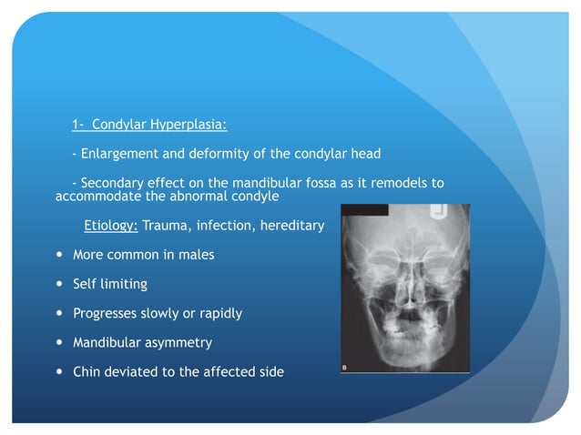 Radiographic imaging of TMJ | PPTX | Bone and Joint Conditions ...