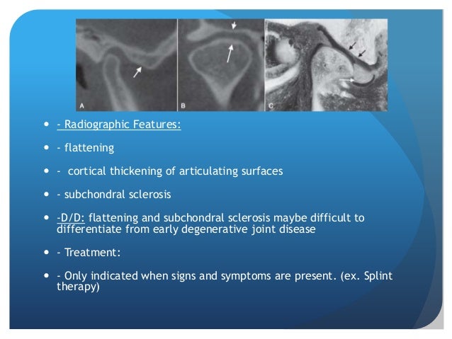 Radiographic Imaging Of Tmj