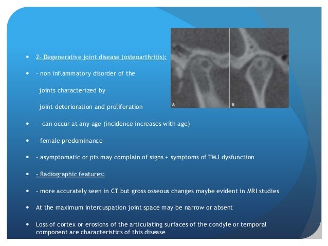 Radiographic imaging of TMJ