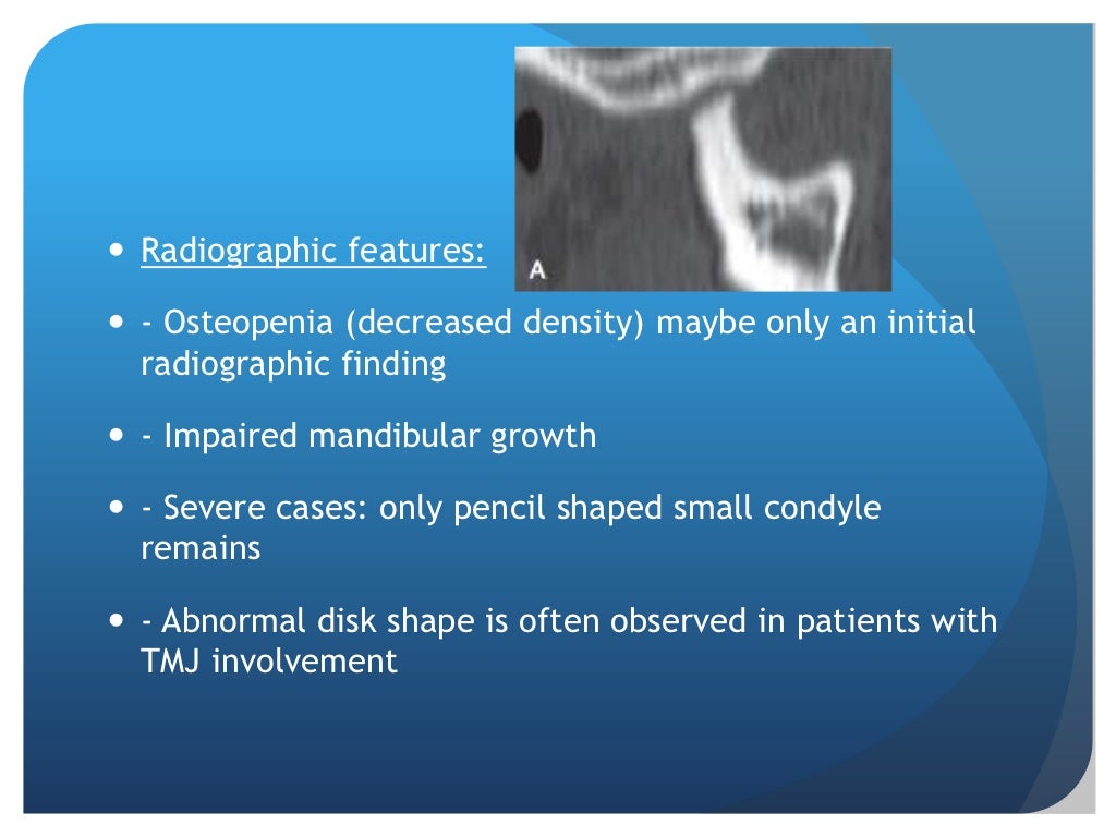 Radiographic imaging of TMJ