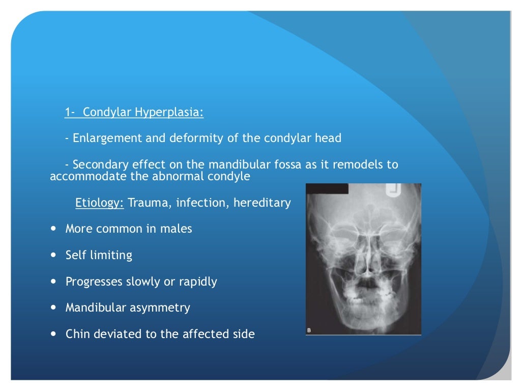 Radiographic Imaging Of Tmj