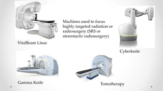 Radiosurgery for brain metastases | PPTX