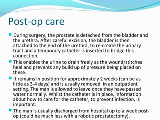 Radical Prostatectomy for Prostate Cancer | PPT