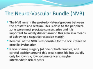 Radical Prostatectomy for Prostate Cancer | PPT