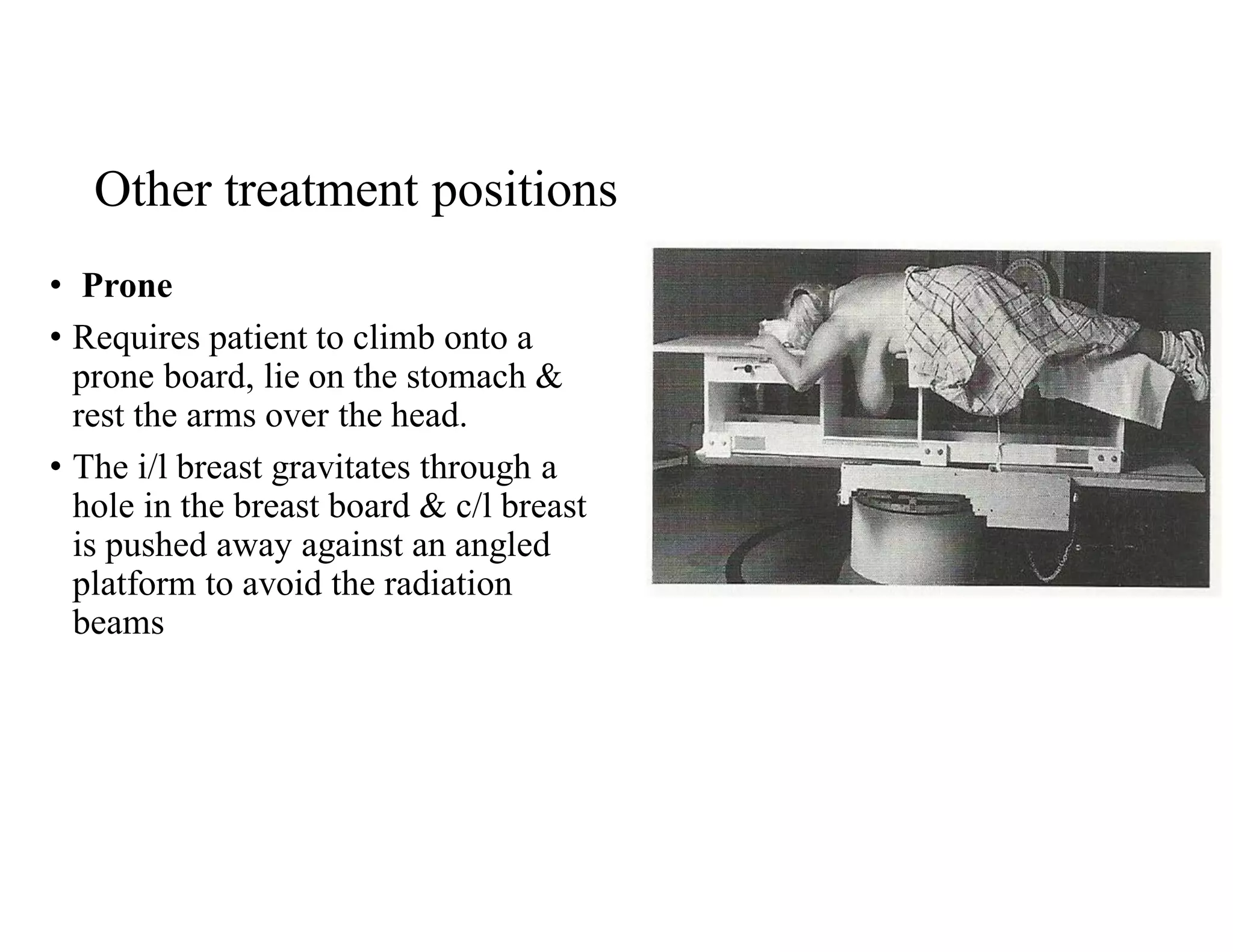Radiotherapy Breast Cancer | PDF