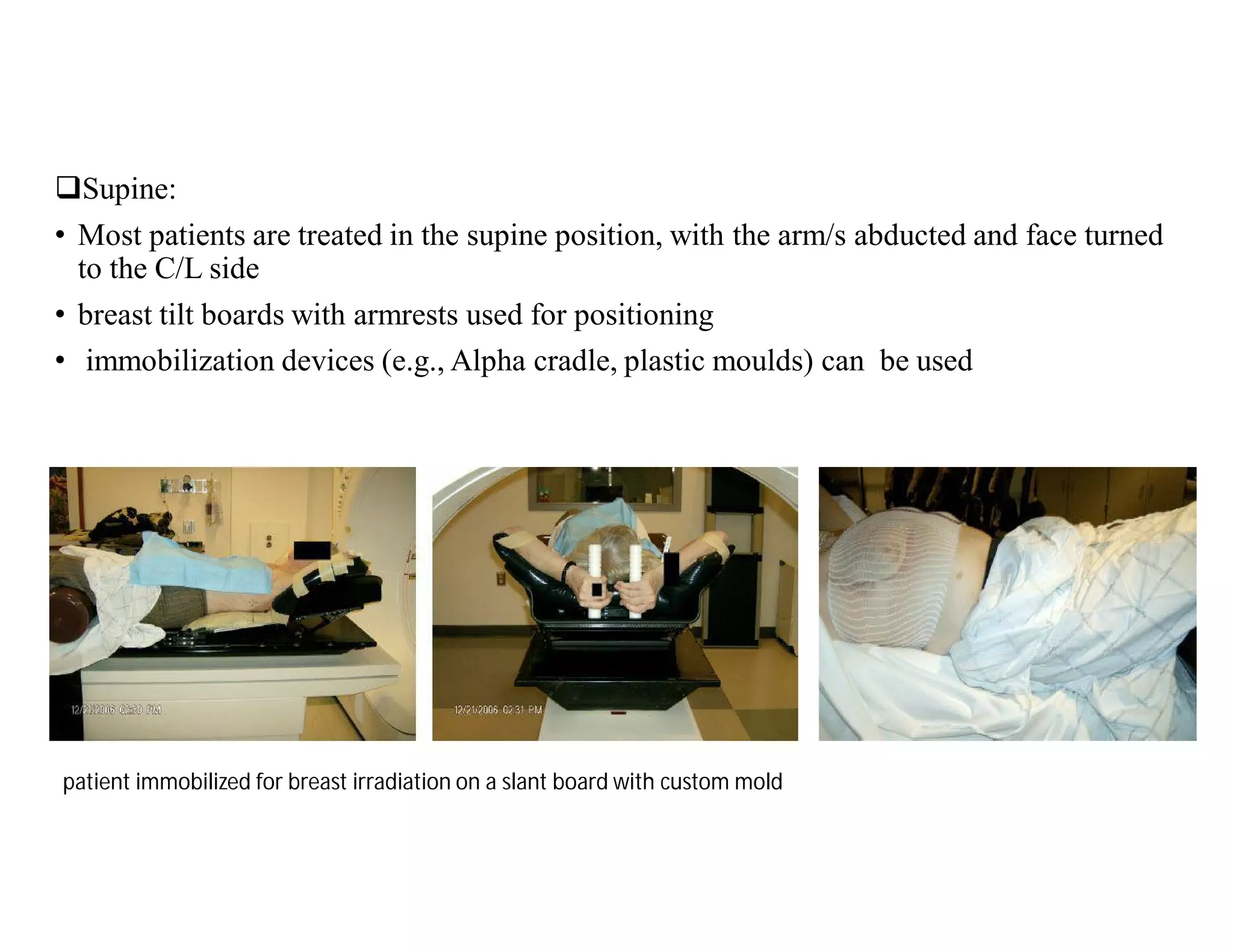 Radiotherapy Breast Cancer | PDF