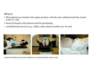 Radiotherapy Breast Cancer | PDF