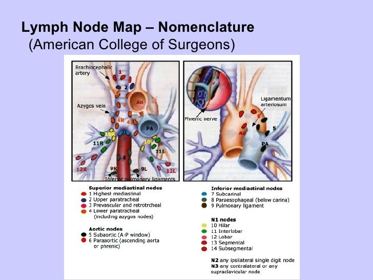 Tcancer Lymph Node Mapping