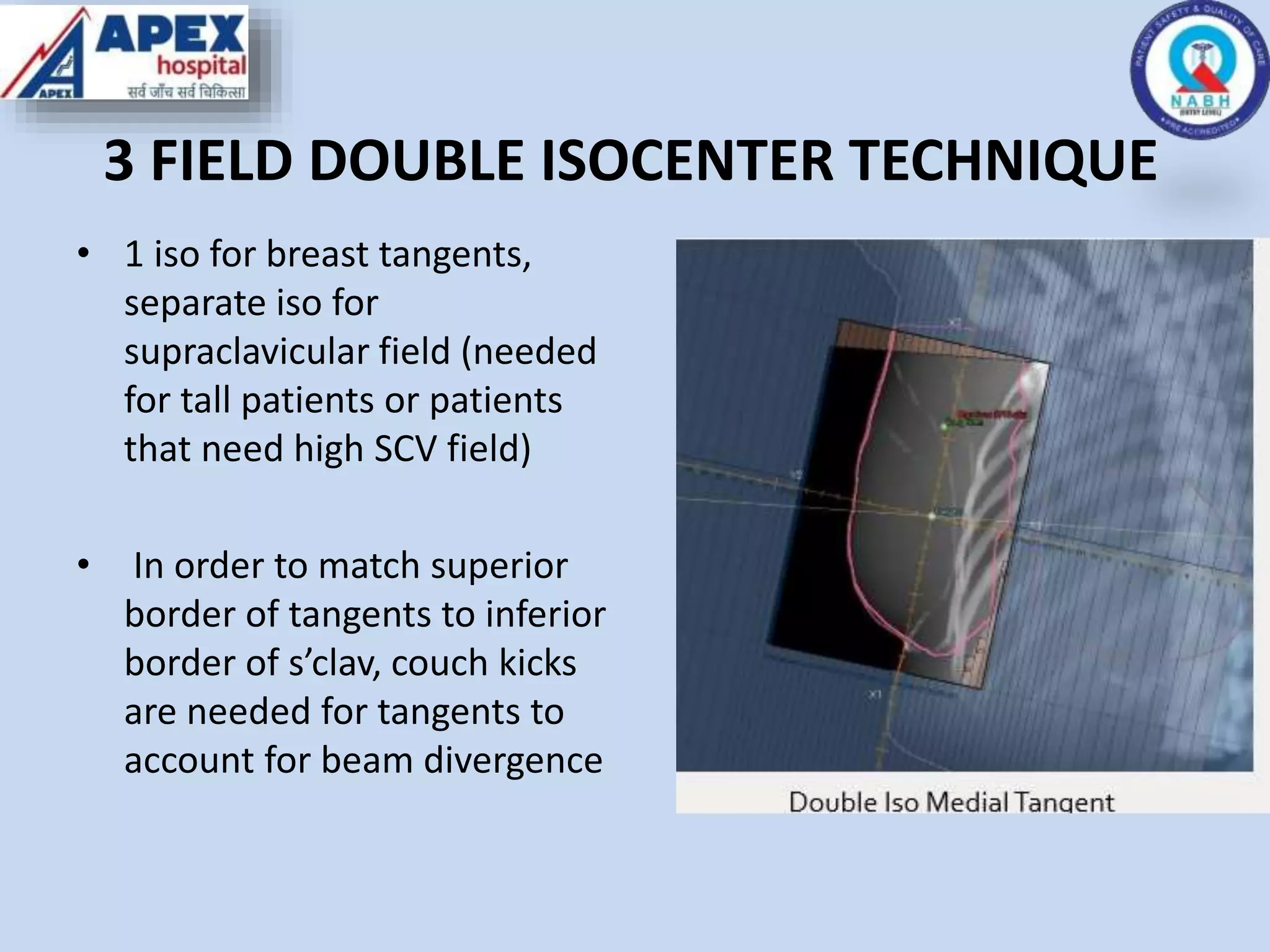 RADIOTHERAPY IN CARCINOMA BREAST (EARLY AND LOCALLY ADVANCED) | PPTX