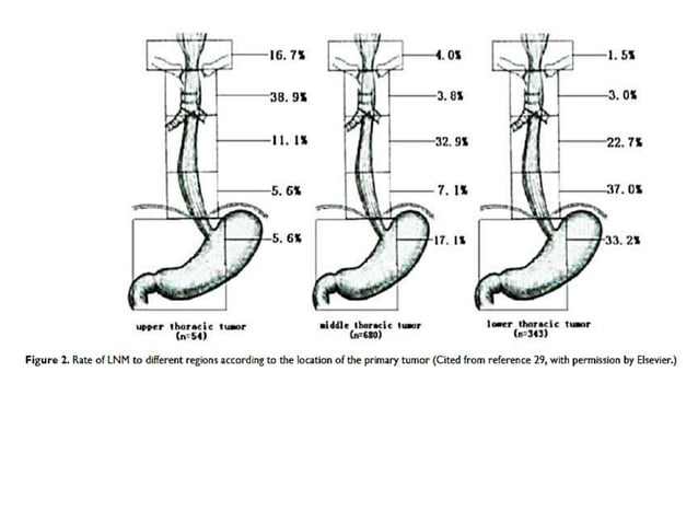Radiotherapy in ca esophagus | PPTX | Cancer | Diseases and Conditions