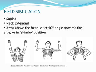 Radiotherapy lymphoma | PPT