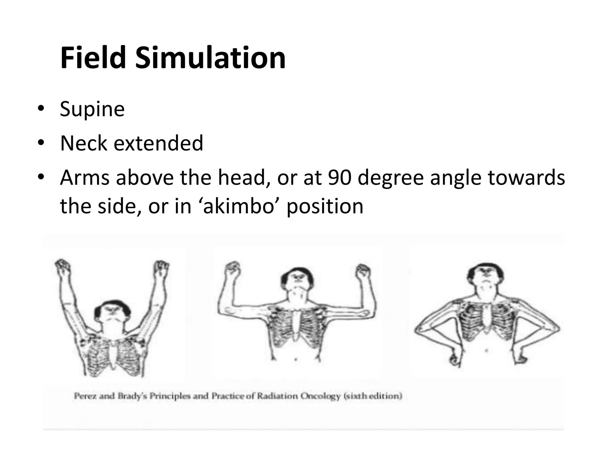 Radiotherapy planning in lymphoma | PPTX