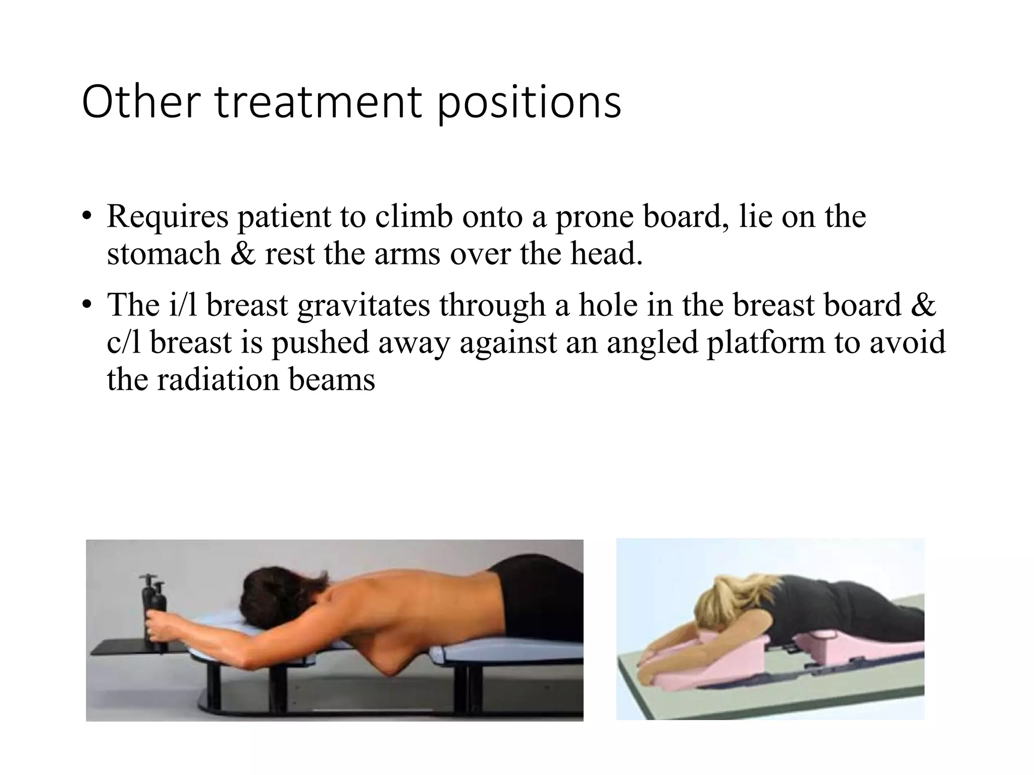 Radiotherapy techniques for Breast Cancer | PDF