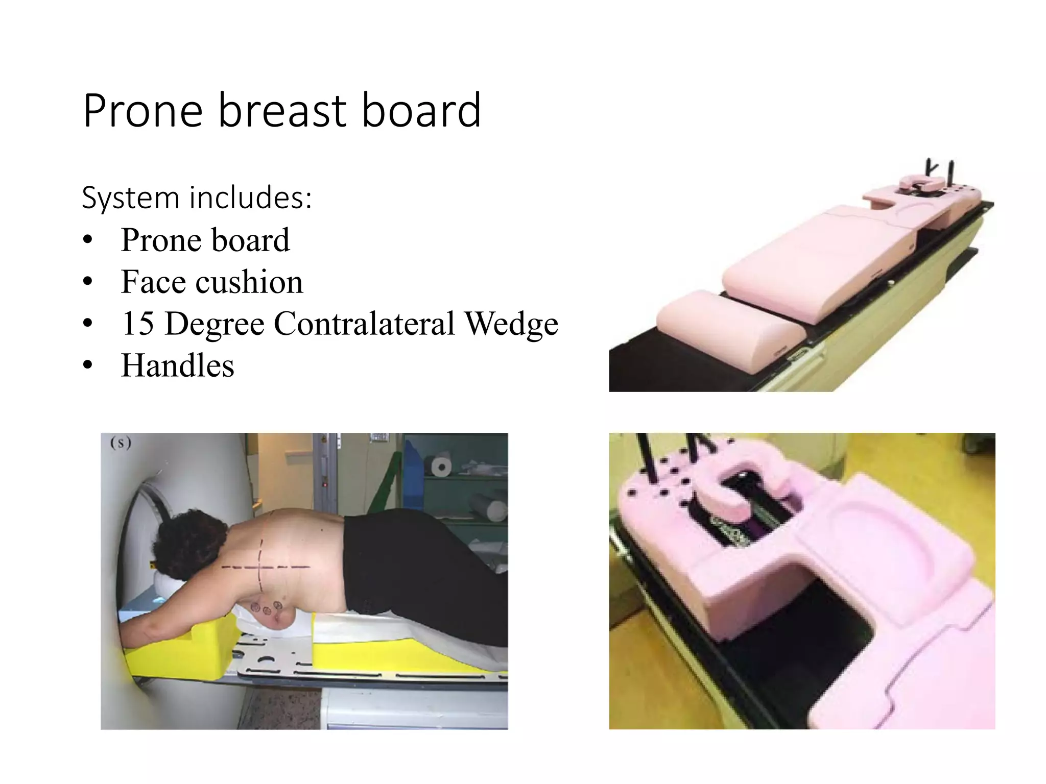Radiotherapy techniques for Breast Cancer | PDF