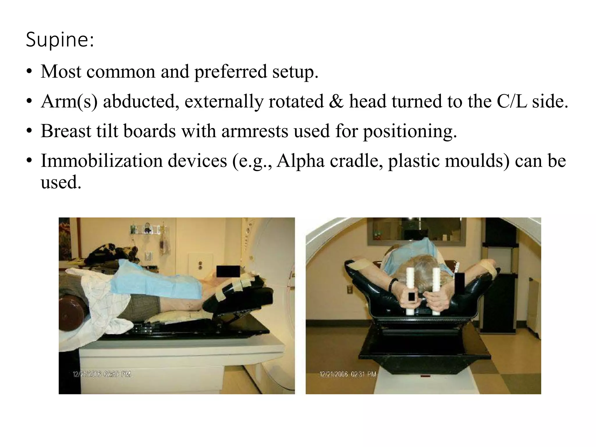 Radiotherapy techniques for Breast Cancer | PDF
