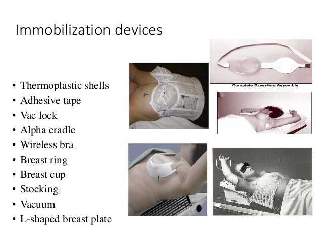 Radiotherapy techniques for Breast Cancer