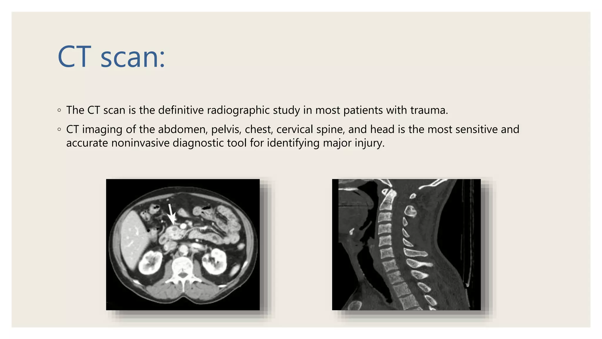 Radiology of trauma patients | PPTX