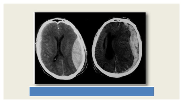 Radiology of trauma patients | PPTX | First Aid | Injuries