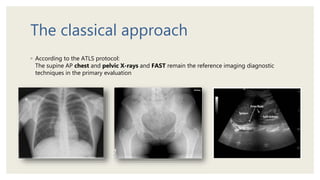 Radiology of trauma patients | PPTX