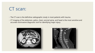 Radiology of trauma patients | PPTX