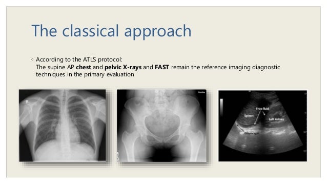 Radiology of trauma patients