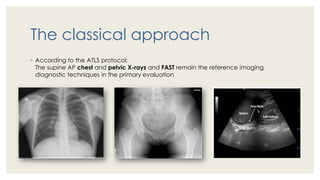 radiotrauma-iiigighig.pdf....................... | PPT