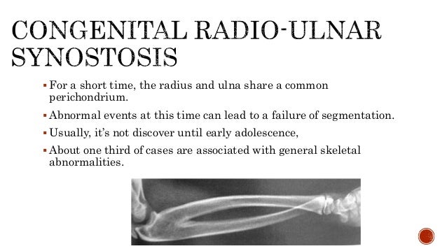 Radioulnar synostosis