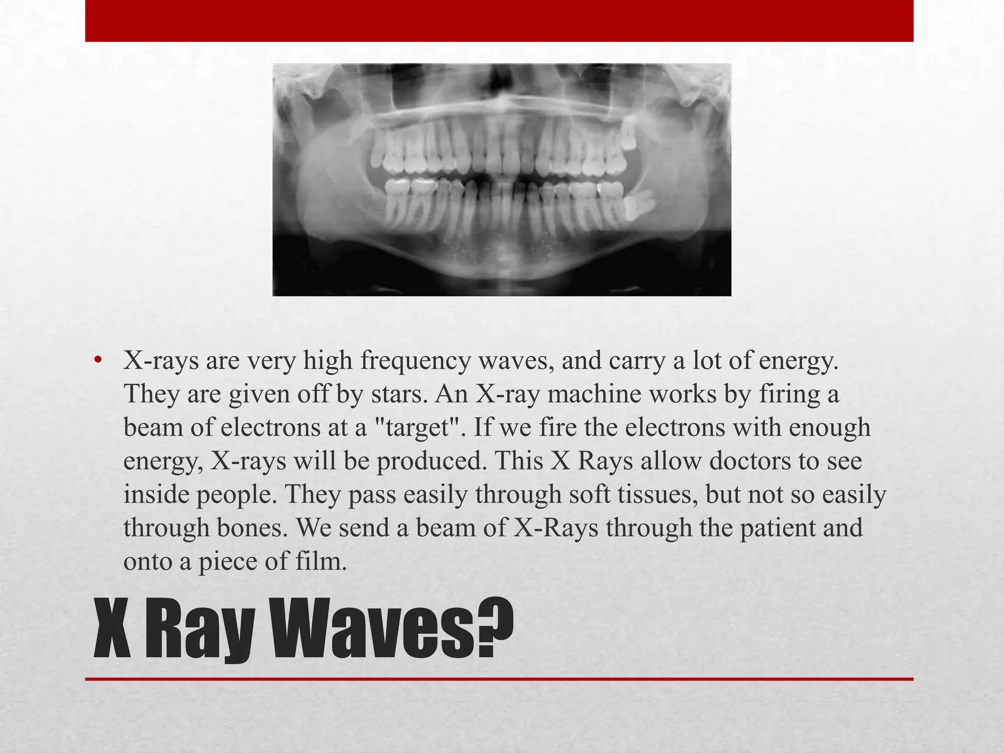 Radio waves | PPT