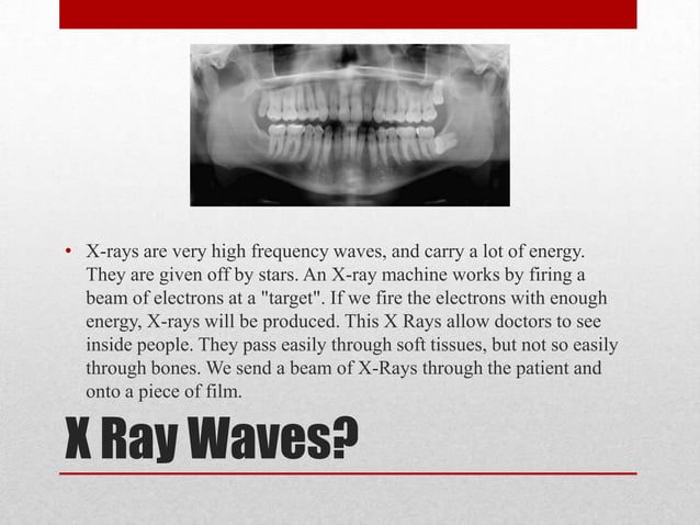 Radio waves | PPT