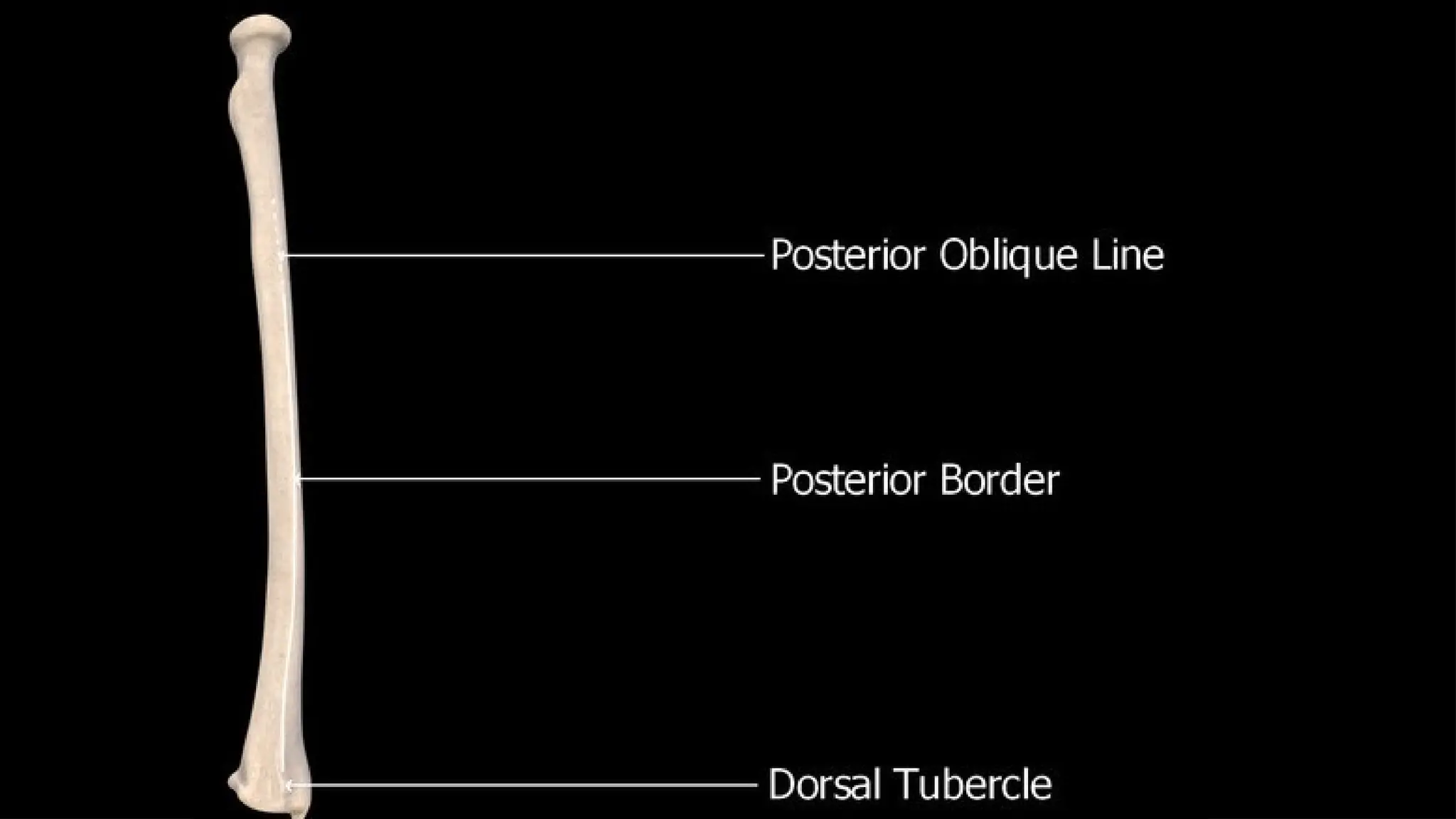 RADIUS BONE Anatomy(02,15,45,51) (1).pptx