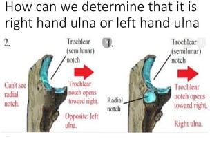 Radius and ulna.pptx