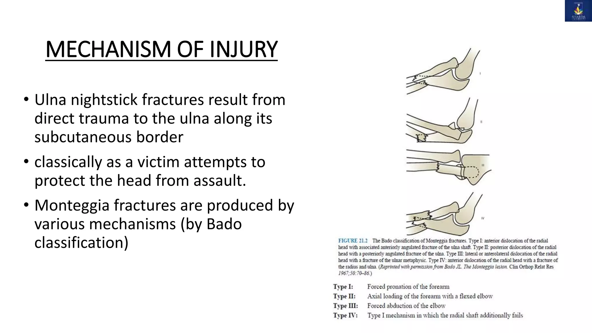 Radius and Ulna Shaft Fracture | PPTX