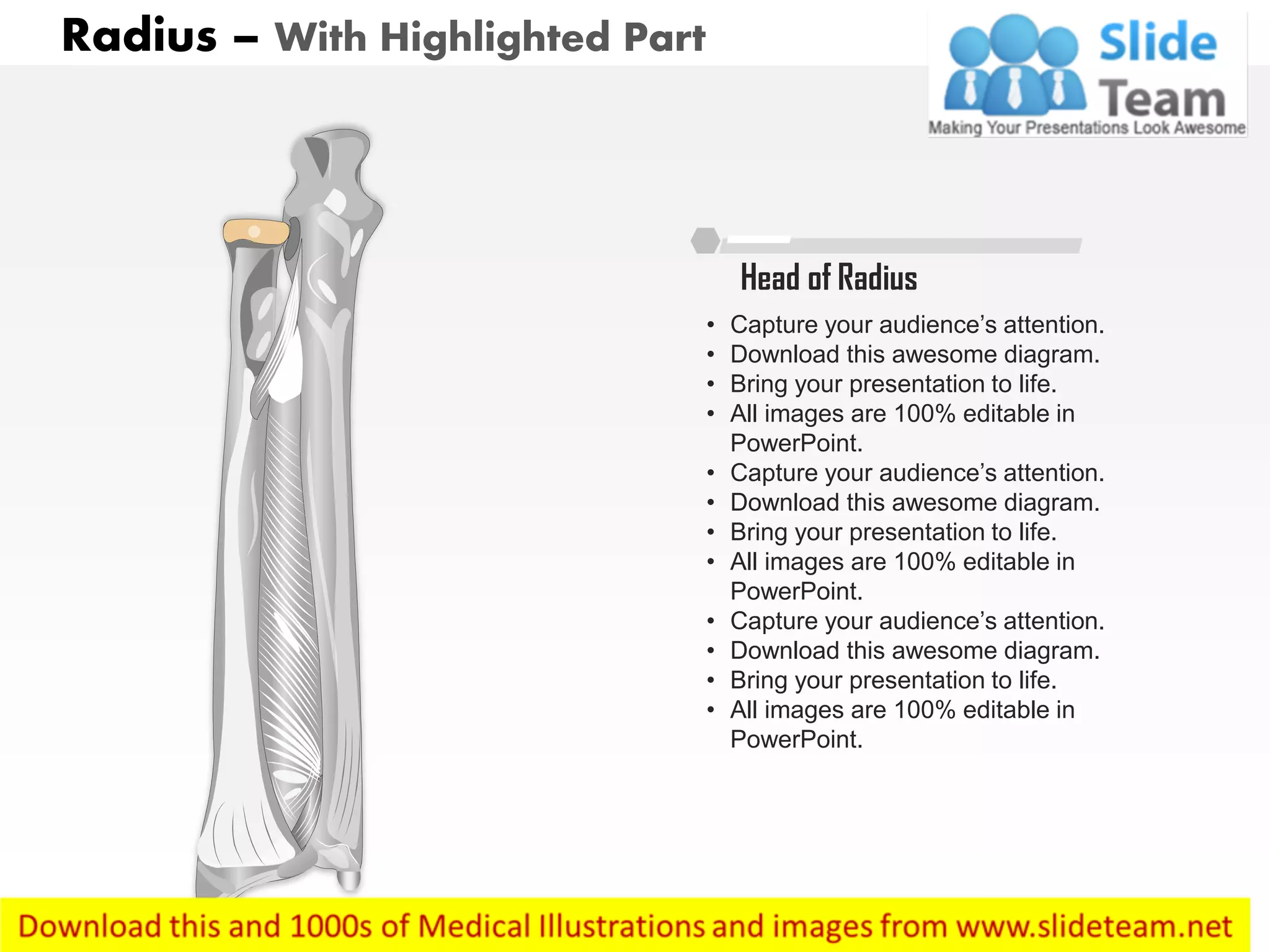 Radius anterior view medical images for power point | PPT