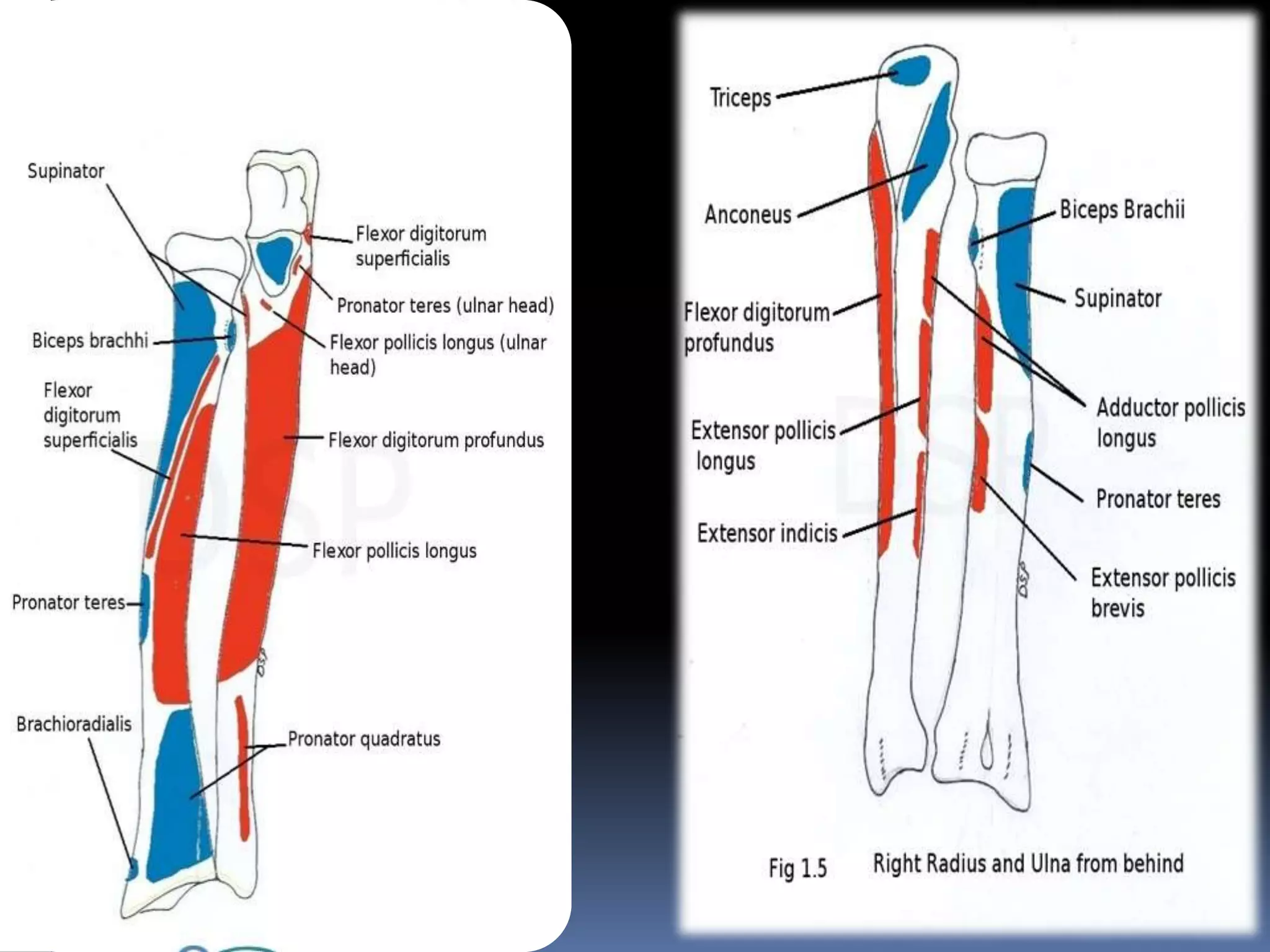 Radius bone anatomy | PPTX