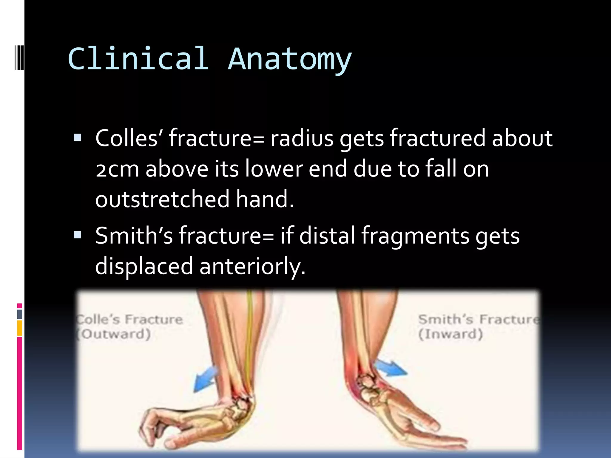 Radius bone anatomy | PPTX