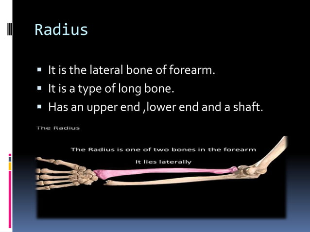 Radius bone anatomy | PPTX | Death, Injury, or Military Conflict | Sensitive Topics