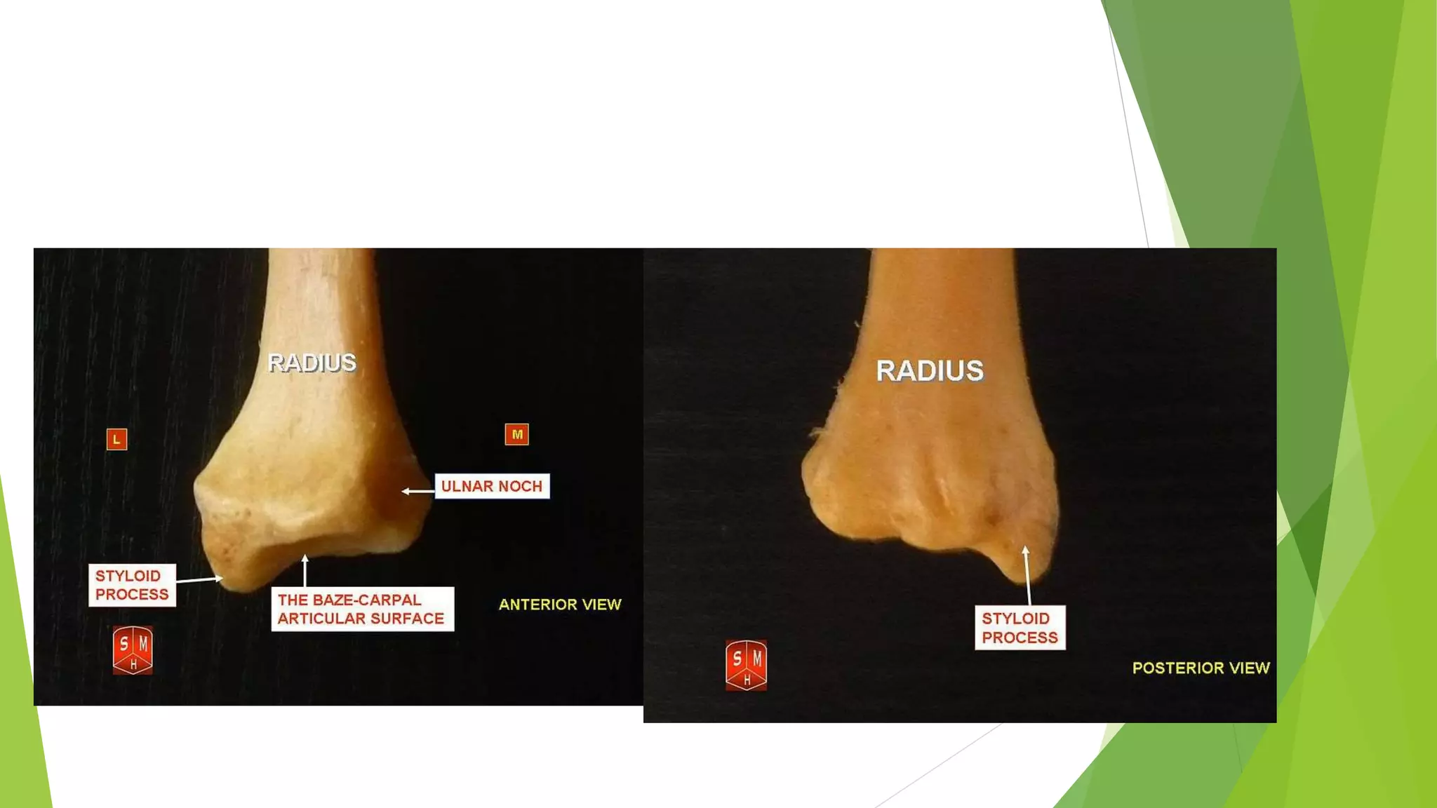 Anatomy of the Radius Bone | PPTX