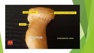 Anatomy of the Radius Bone | PPTX
