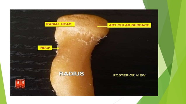 Anatomy of the Radius Bone | PPTX